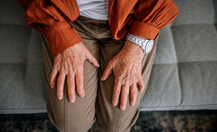 Rheumatoid arthritis - a treat-to-target approach - Med iLearning